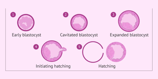 Decoding Your Embryo Report: What Those Numbers Mean in IVF